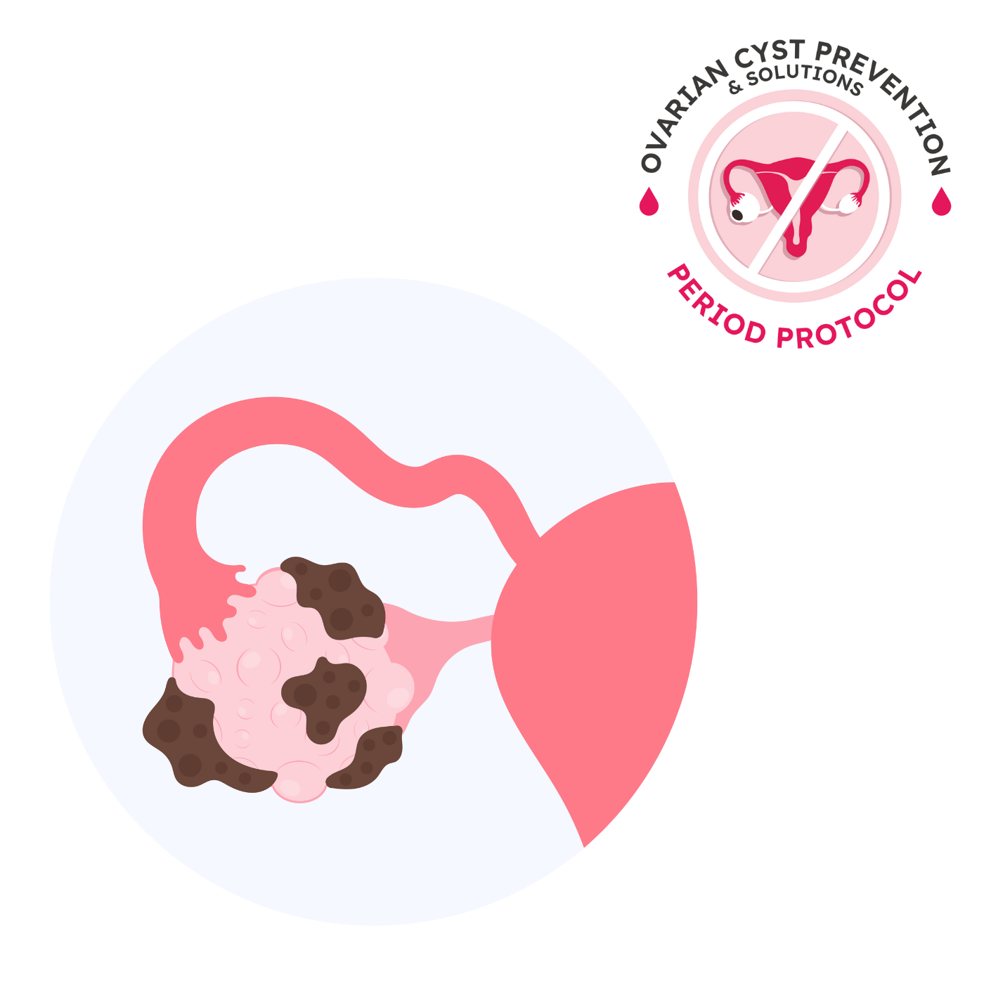 Ovarian Cyst Prevention & Solutions Protocol | Fix Your Period Collective