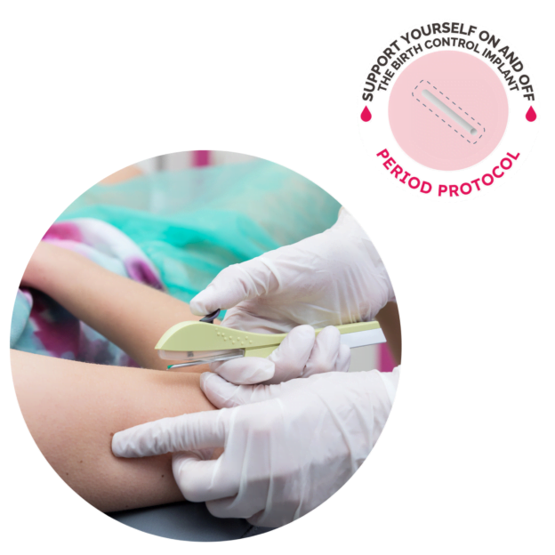 Support Yourself On and Off the Birth Control Implant Protocol | Fix ...