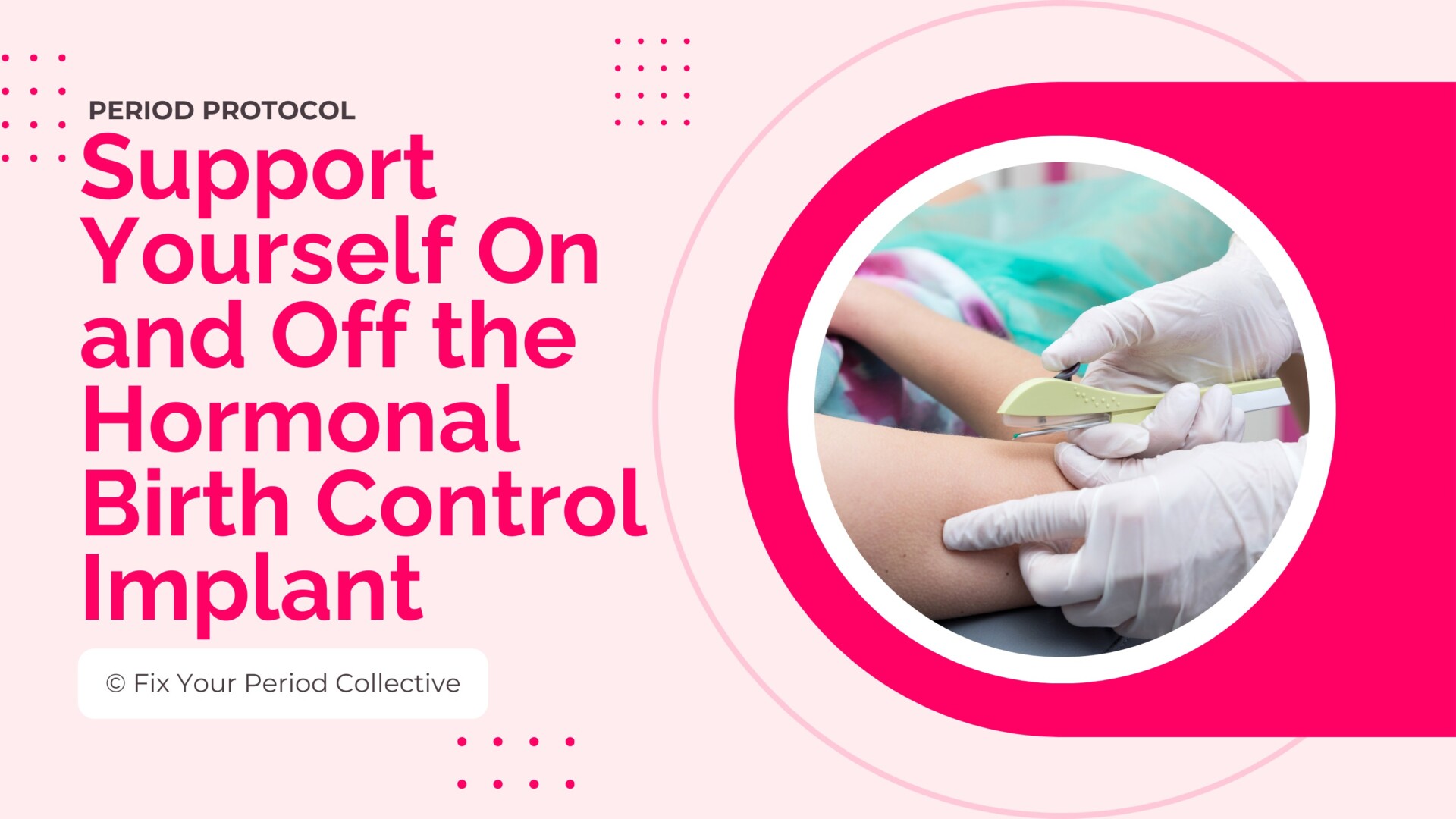Support Yourself On and Off the Birth Control Implant Protocol | Fix ...